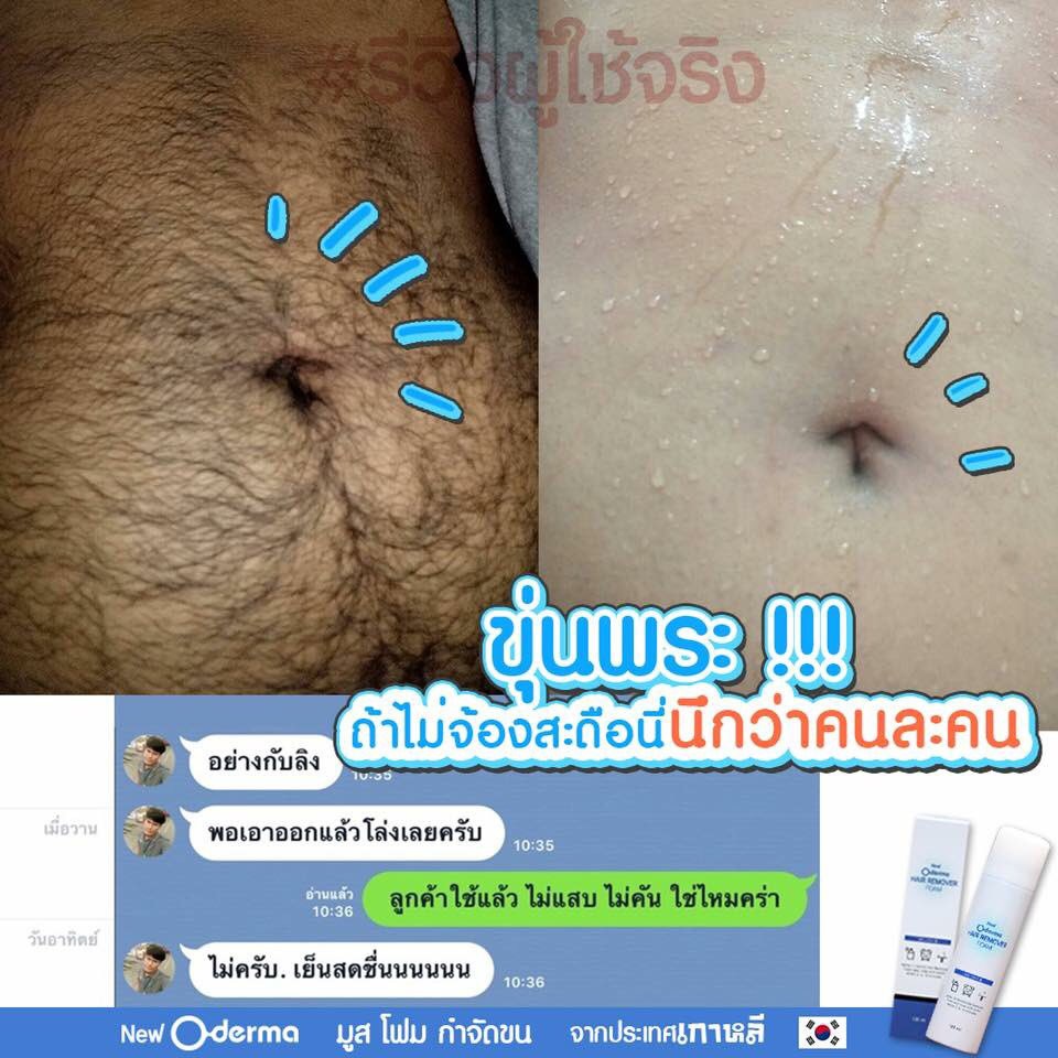 oderma โอเดอม่า มูสโฟมกำจัดขน สเปรย์กำจัดขน มูสกำจัดขน - nanthawat032 - ThaiPick