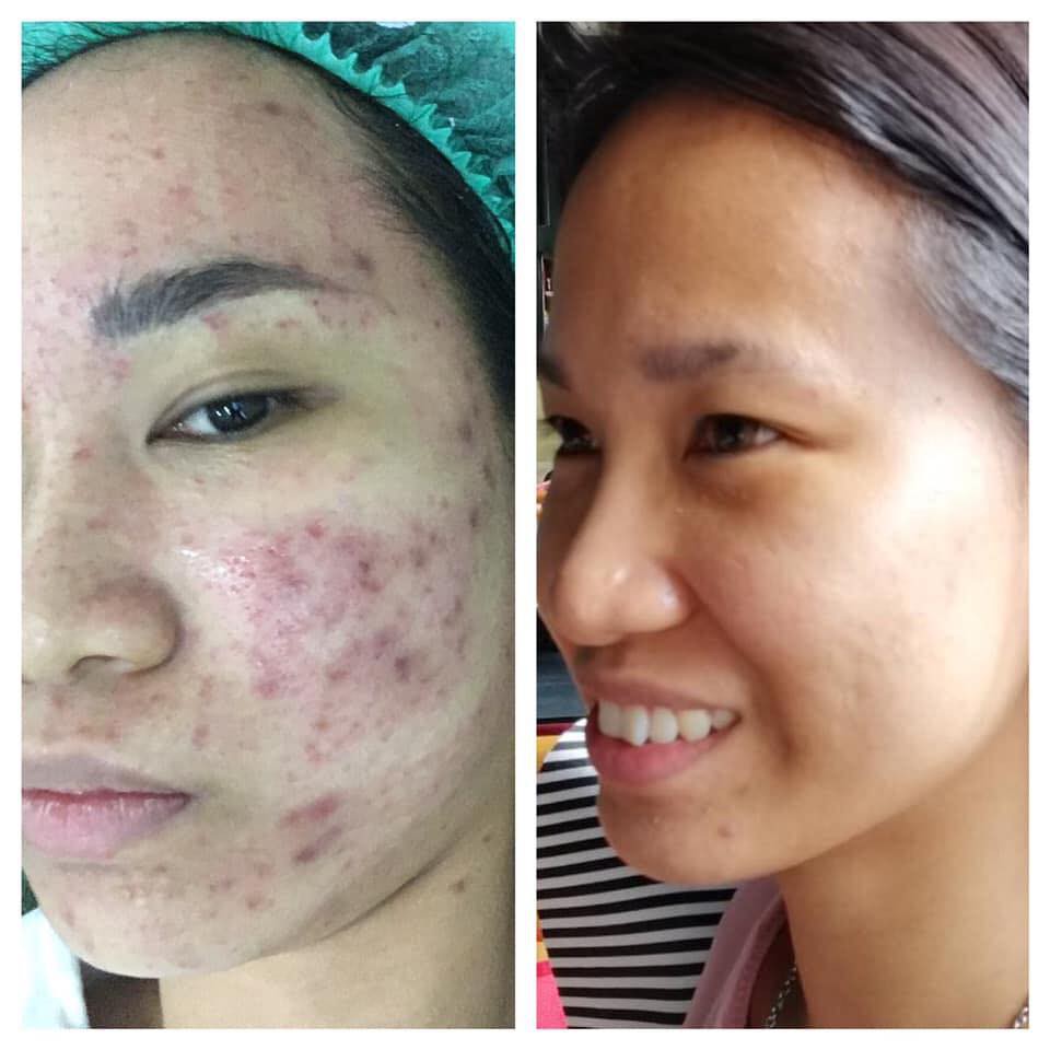 Ray viear Plant Placenta Night Cream à¸„à¸£à¸µà¸¡à¸šà¸³à¸£à¸¸à¸‡à¸œà¸´à ...