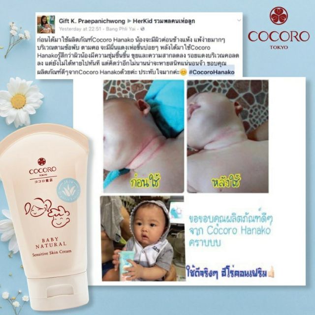 COCORO BABY NATURAL SENSITIVE SKIN ครีมเด็ก ผื่นร้อน ผิวแห้ง ผดร้อน ผื่นภูมิแพ้ ผื่นคัน คันผิว ...
