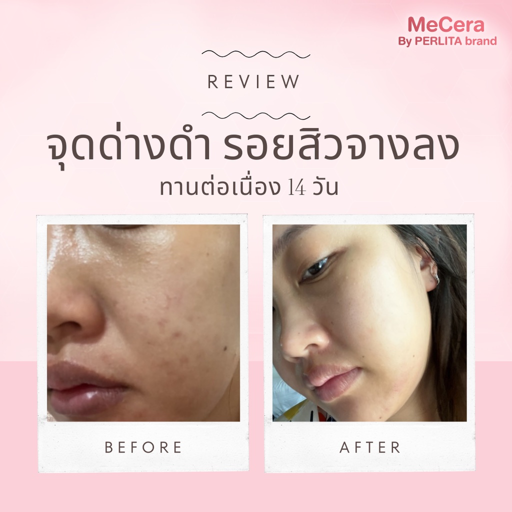MeCera by Perlita Brand Set 2 กล่อง - perlita_brand - ThaiPick
