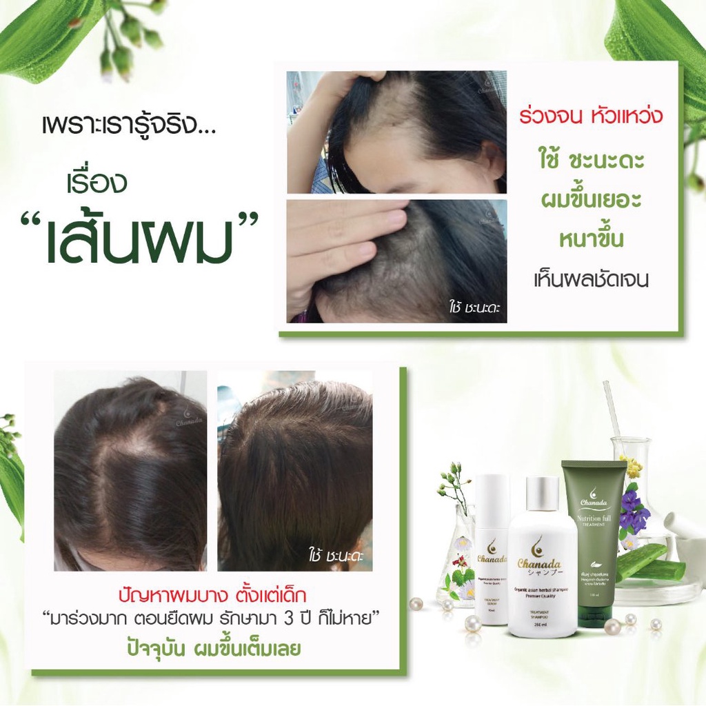 Chanada คุ้มที่สุด️ 2แถม1 ลดผมร่วง สร้างผมหนา ผมนุ่มลื่น เงางาม ส่งฟรี ...