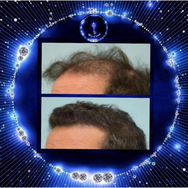 pip Minox 5 Minoxidil 5 mg - keytoyouth666 - ThaiPick