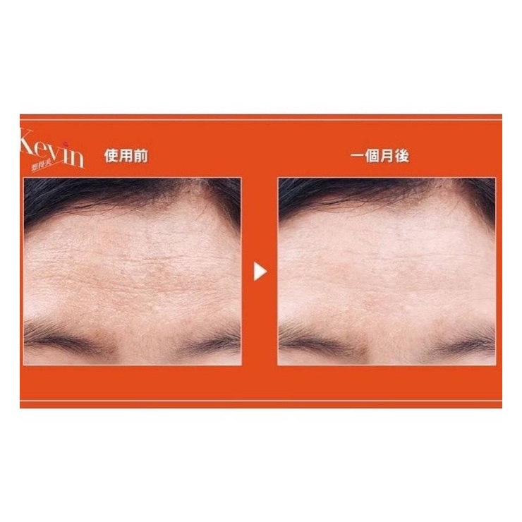 เซ็ต POLA Wrinkle Shot 3D Program Kit 3pcs. - spnw8 - ThaiPick