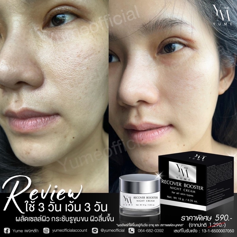 YUME RECOVER BOOSTER NIGHT CREAM ลดรูขุมขนกว้าง หน้าใส ผิวเรียบเนียน ...