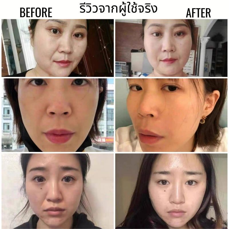 แผ่นมาส์กหน้าตึง Hunmui mask มาส์กหน้าขาวใสไร้ริ้วรอย เพิ่มความชุ่มชื้น ...