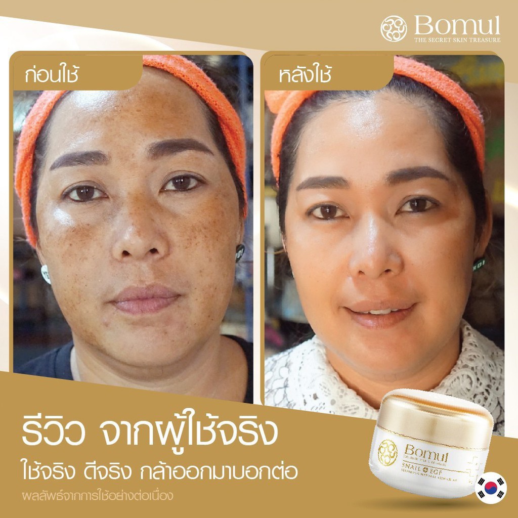 ขายดีมาก แนะนำ Bomul Snail Cream+EGF ครีมโบมุล ครีมบำรุงผิว ช่วยให้ฝ้า ...