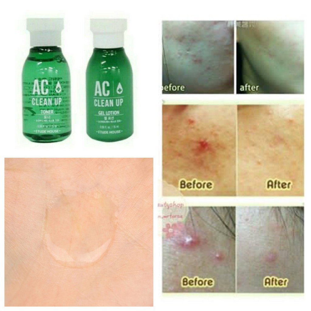 เซตรักษาสิว ขั้นเทพ Etude House AC Clean Up Gel Toner 15 Ml + Lotion 15 ...