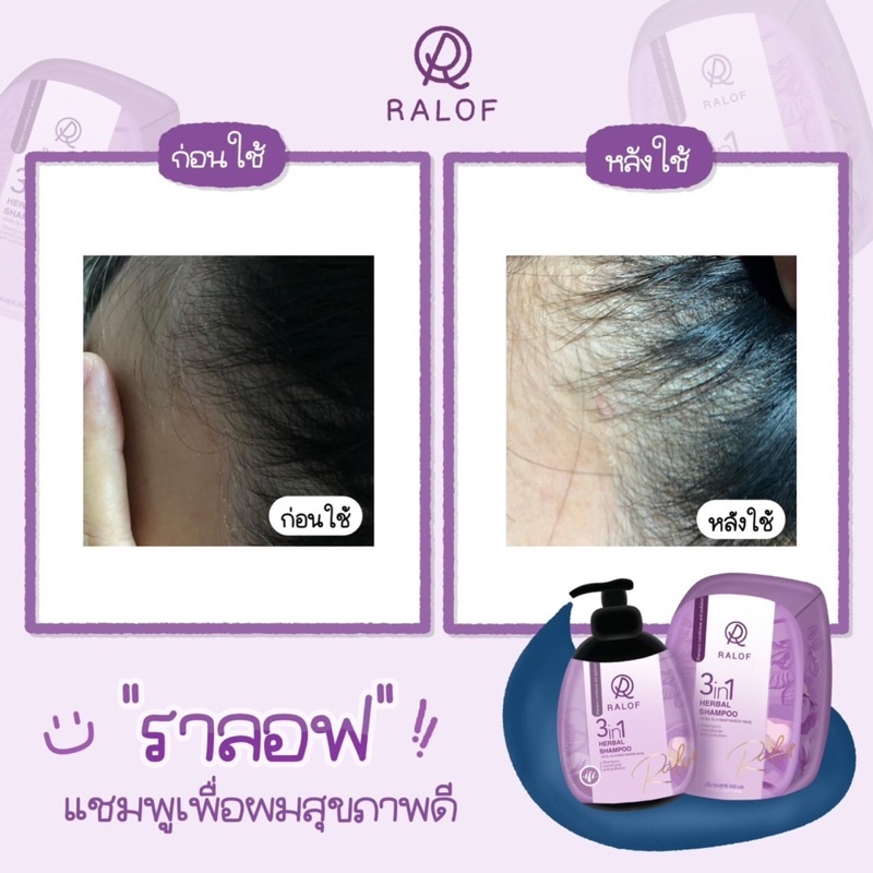 ralof แชมพู ถูกที่สุด พร้อมโปรโมชั่น เม.ย. 2025 | BigGoเช็คราคาง่ายๆ