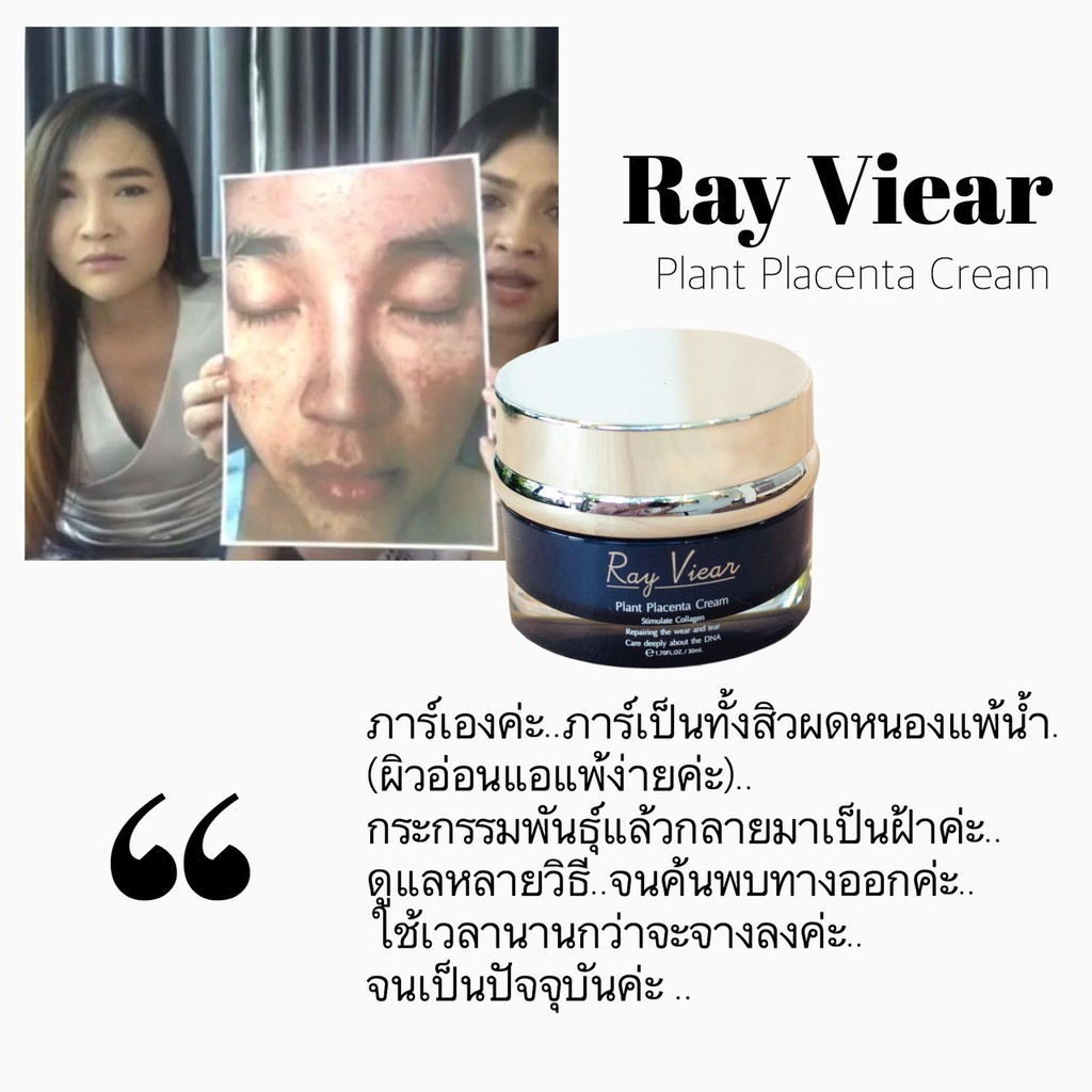 ส่งฟรี ครีม บำรุงผิว(Ray Viear) ตัวช่วยเรื่องสิว ฝ้า กระ ฟื้นฟูผิวแพ้ ...