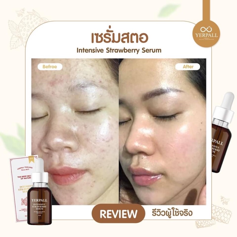 เซรั่มสตอเบอรี่ Intensine Strawberry Serum - tontoey_pcrp - ThaiPick