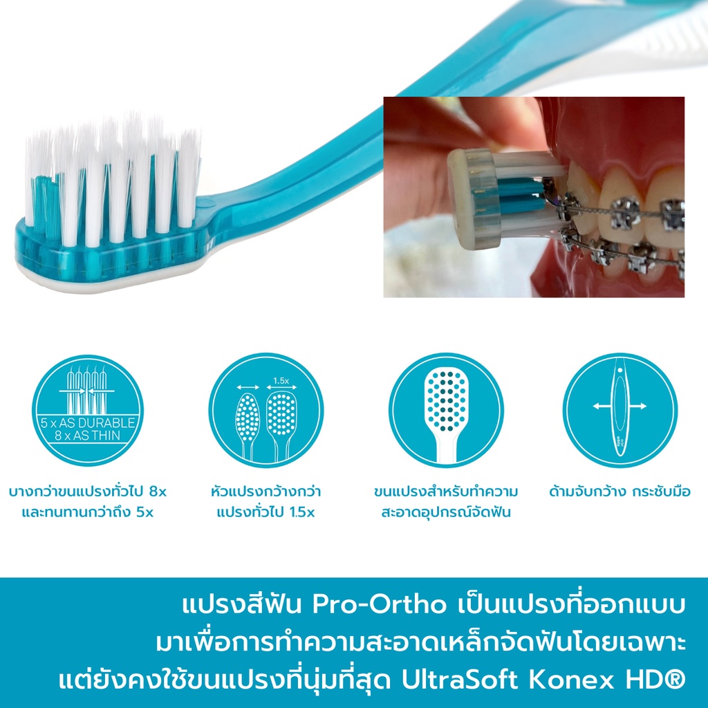 [สำหรับคนจัดฟัน] edel+white Pro-Ortho แปรงสีฟันสำหรับคนจัดฟัน - edel ...