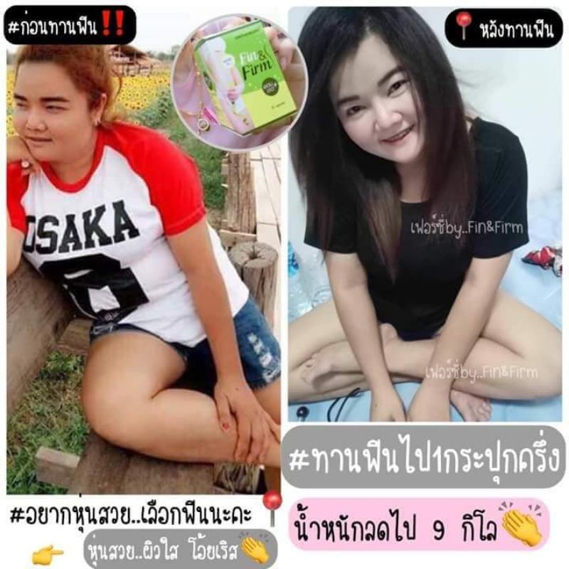 แท้100พร้อมส่ง FinFirm ฟินแอนด์เฟิร์ม อาหารเสริมลดน้ำหนัก กระชับสัดส่วน มีของแถมทุกออเดอร์ ...