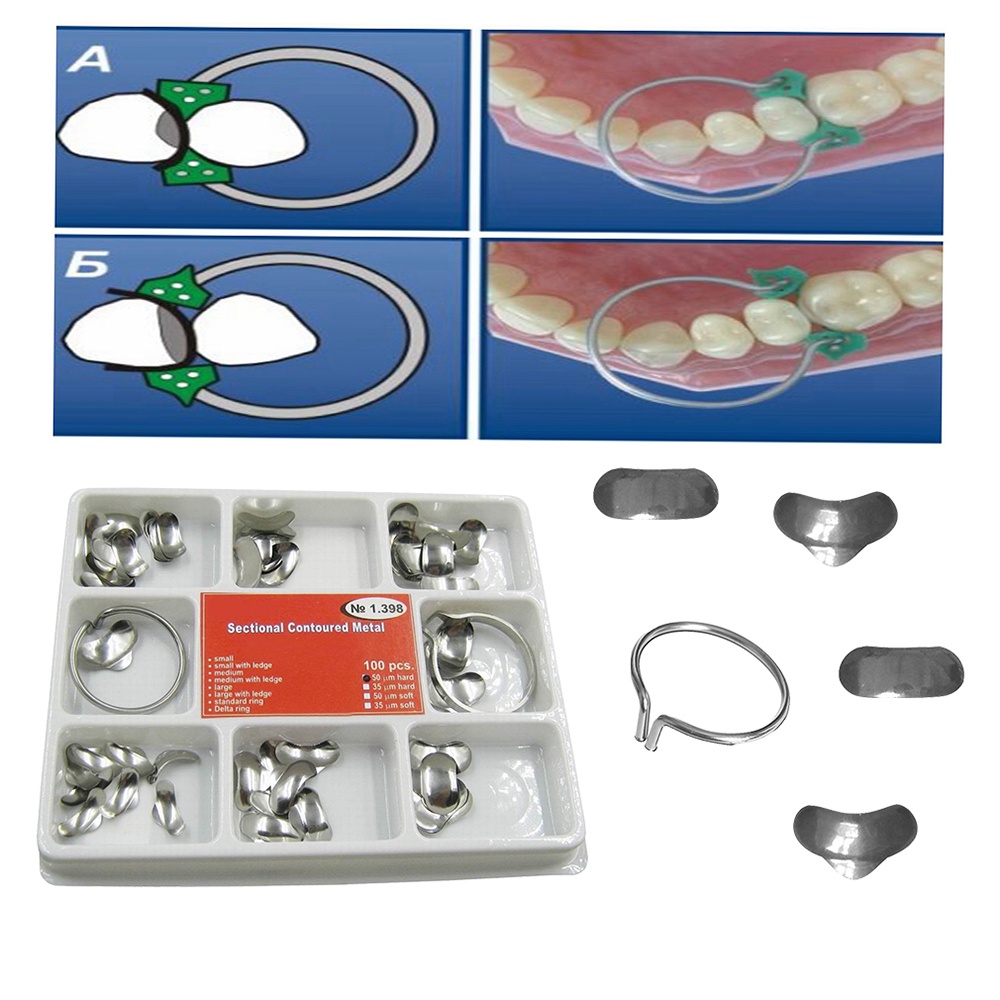 100Pcs Full Kit Dental Matrix Sectional Contoured Metal Matrices No.1. ...