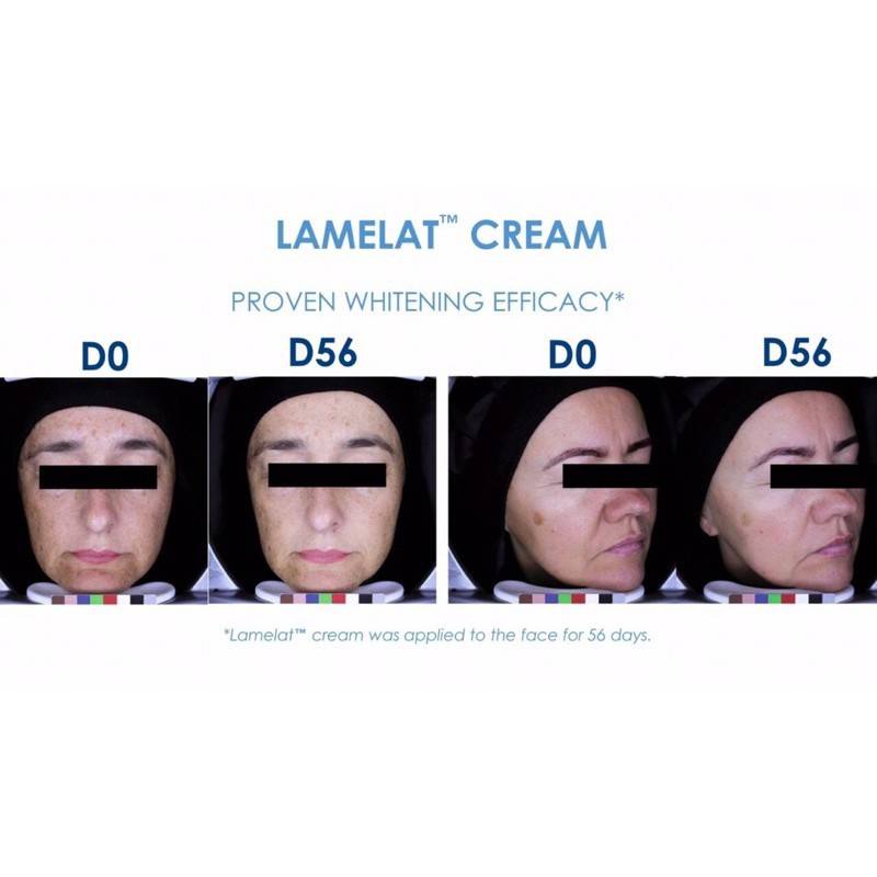 PHARMANN Lamelat Laserat Cream Arnizen Cream Visaderm cream gel tonic ...