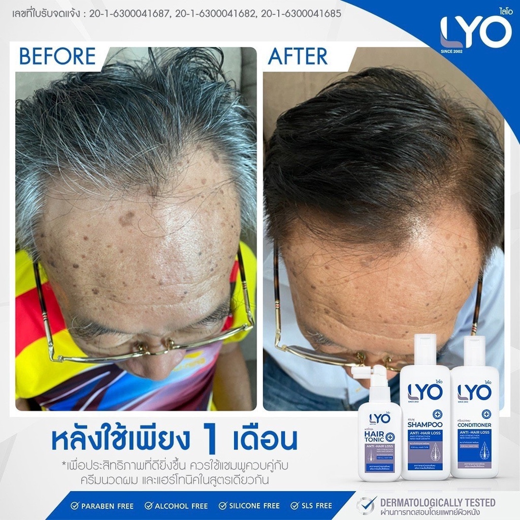 ส่งฟรี แท้ 100 ส่งจากบริษัท LYO ไลโอ หนุ่มกรรชัย แก้ปัญหาผมร่วง เสริมรากผมใหม่ให้แข็งแรง - tnmm ...