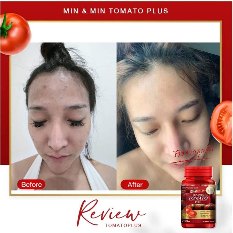 Minmin Tomato plus Whitening blink มะเขือเทศญี่ปุ่น ของแท้ - dragon ...