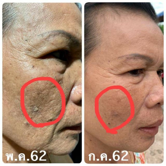 ส่งฟรี Ray Viear Plant Placenta Cream - vinnara - ThaiPick