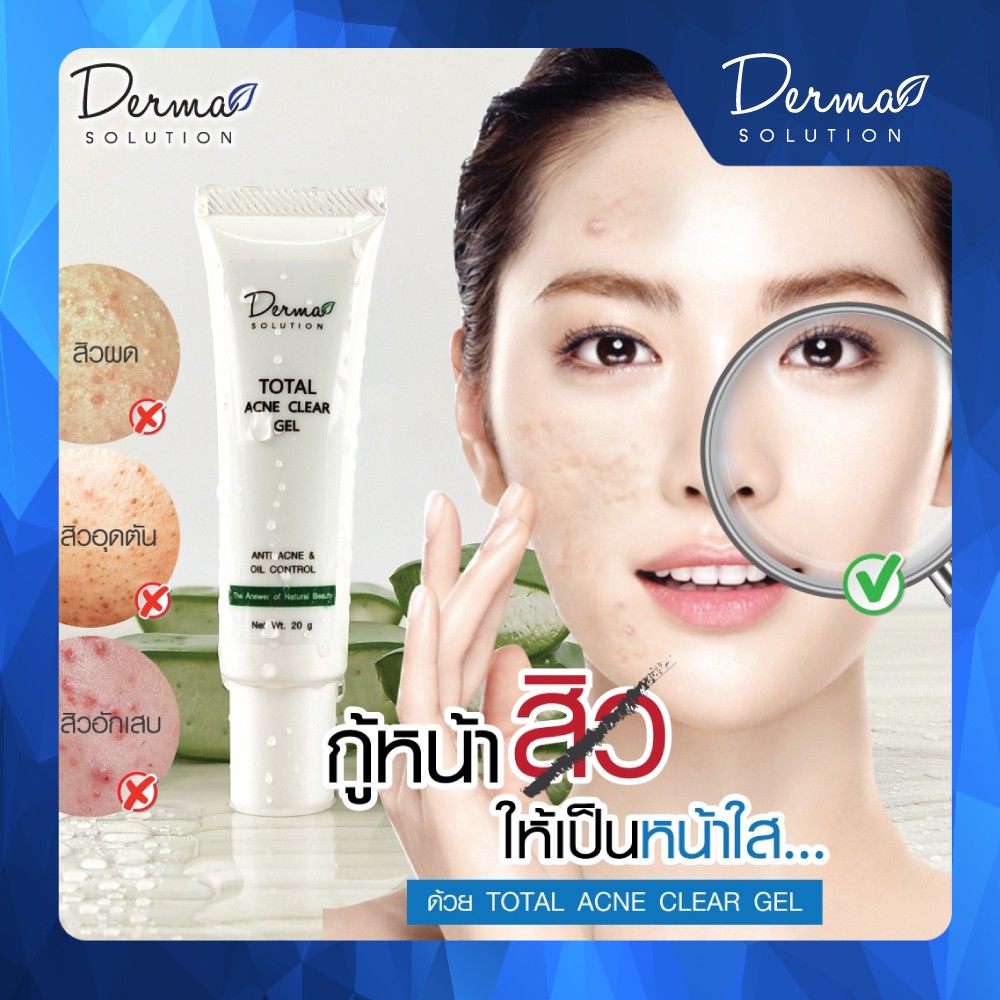 Total Acne Clear Gel (20 g) เจลทาสิว สิวอักเสบ ยุบทันใจชัวร์ ลด สิวอุด ...