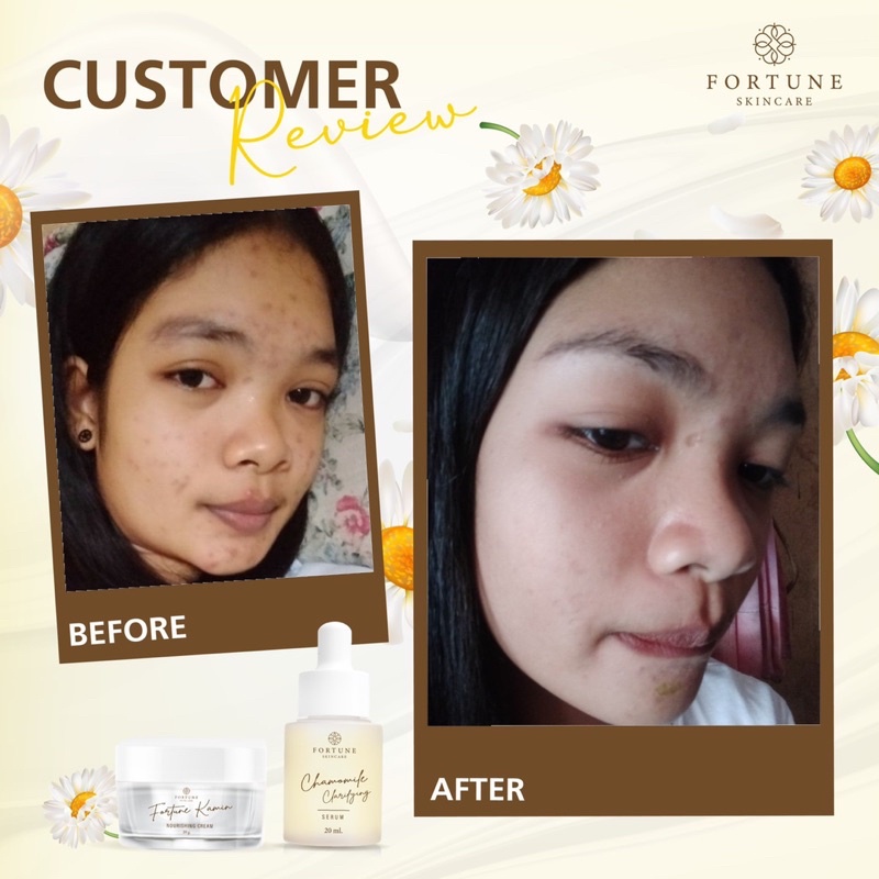 เซรั่มคาร์โมมายด์ลดสิวส่งฟรี - thebestskincare.99 - ThaiPick