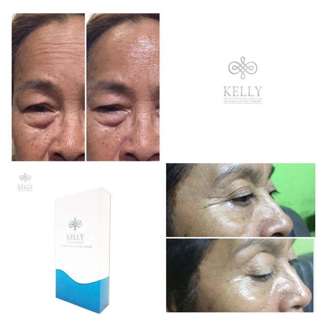 Kelly Serum (เคลลี่ เซรั่ม) ลดริ้วรอย ปรับผิวเรียบเนียน 1 กล่อง (15ซอง ...