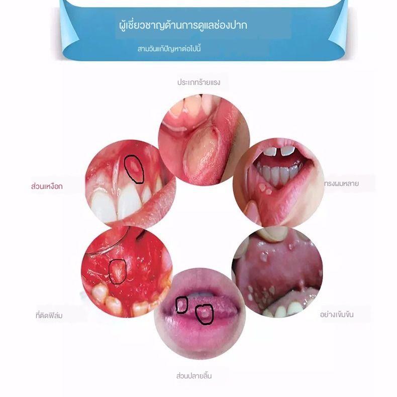 มลัก Coral Oral Spray Sore Mouth Fire Foaming Watermelon Cream Ulcer ...