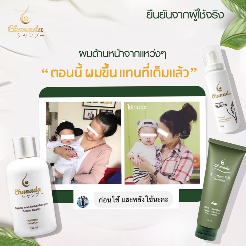 Chanada ️เซรั่มลดผมร่วง ️กระตุ้นผมงอกใหม่ เร่งผมยาว x2 ส่งฟรีมีของแถม ...