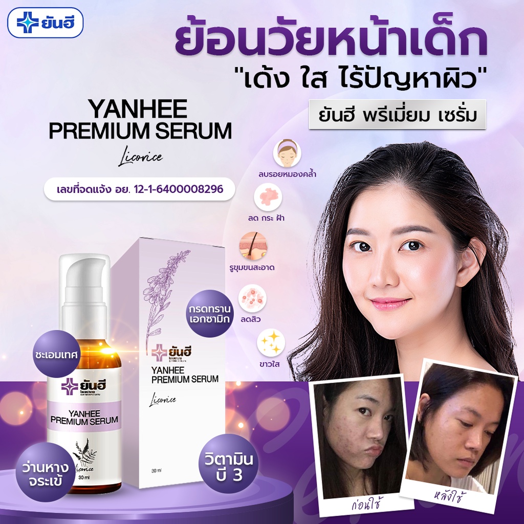 YANHEE PREMIUM SERUM เซรั่มยันฮีพรีเมี่ยม ของแท้ 100 แก้ สิว ฝ้า กระ ...