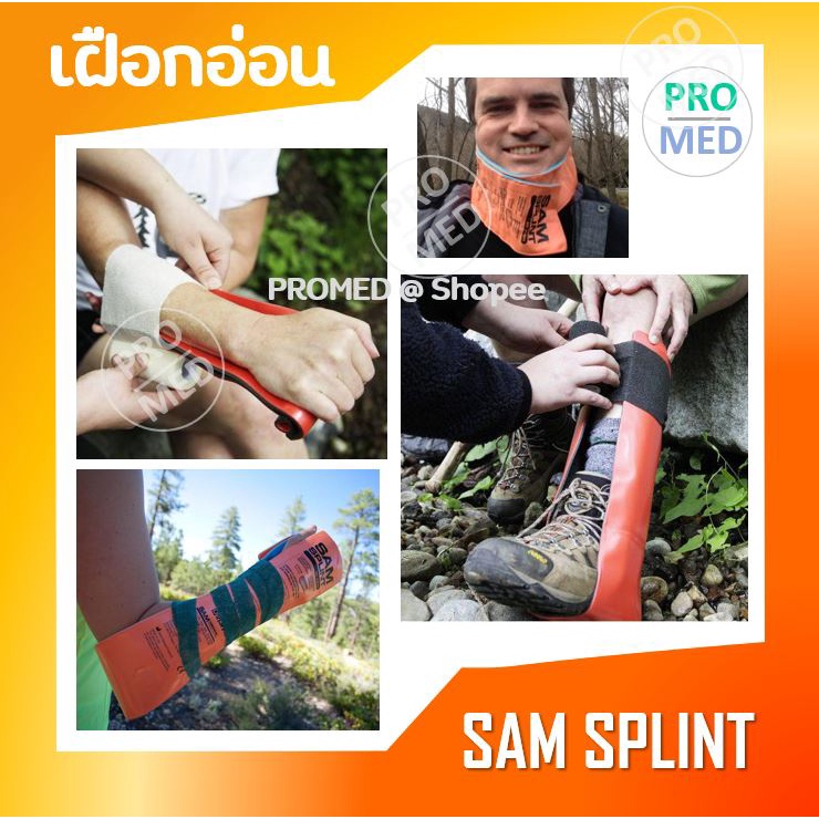 SAM Splint 36 นิ้ว เฝือกอ่อน เฝือกอ่อนม้วน เฝือกอ่อนพกพา ทางยุทธวิธี ...