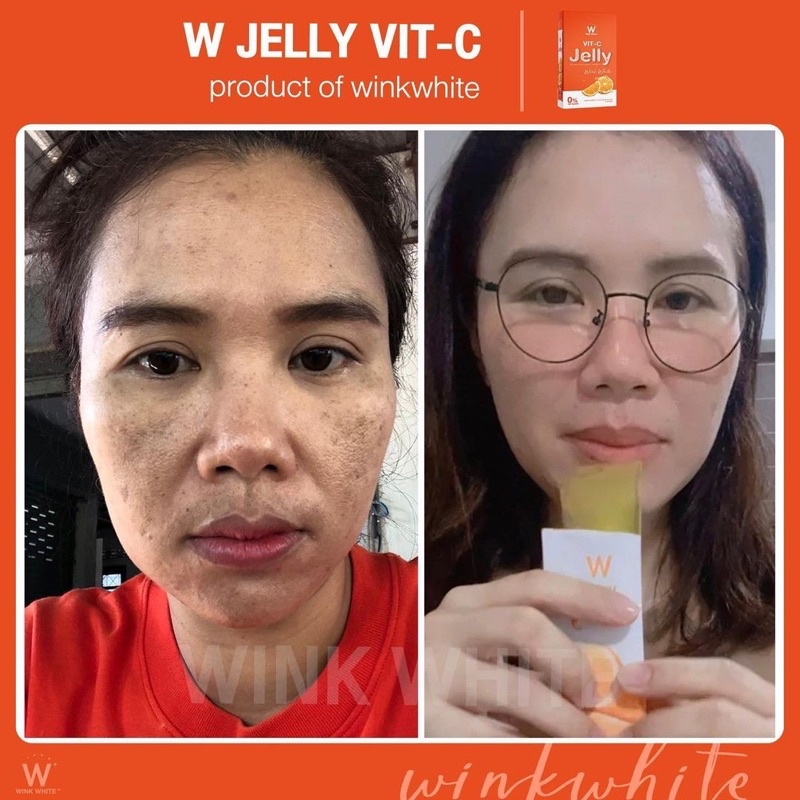 (ของแท้) 3 แถม 4 ส่งฟรี WINK WHITE วิ้งไวท์ W Jelly ดับเบิ้ลยู เจลลี่ไฟเบอร์ เจลลี่คอลลาเจน เจล ...