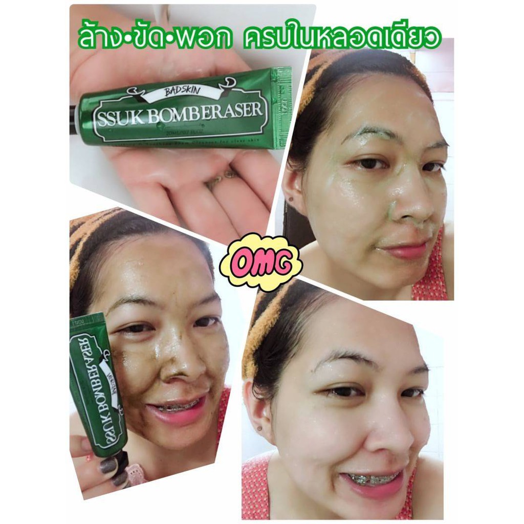 SSUK BOMB ERASER ผลิตภัณฑ์ดูแลผิวหน้านำเข้าจากประเทศเกาหลี ช่วยผลัด ...