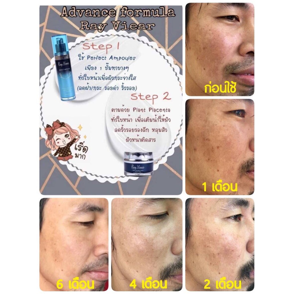 Ray viear Plant Placenta Night Cream ครีมบำรุงผิวหน้า - nuunong.shop ...