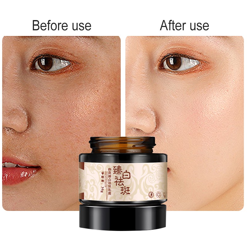 30g Skin Whitening Cream Powerful Whitening Freckle Cream Chinese ...