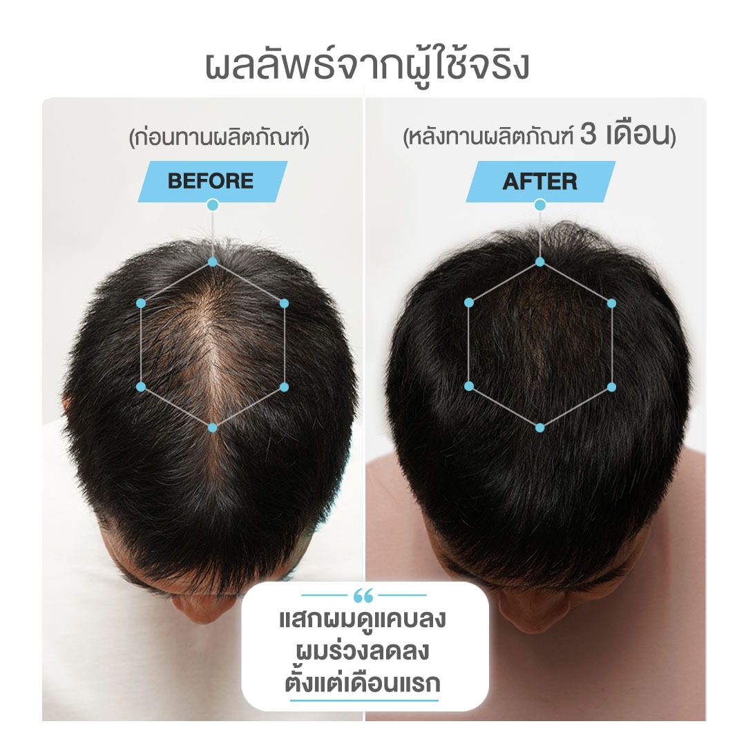 สั่งซื้อสินค้าออนไลน์จาก Bevita official store | Shopee Thailand