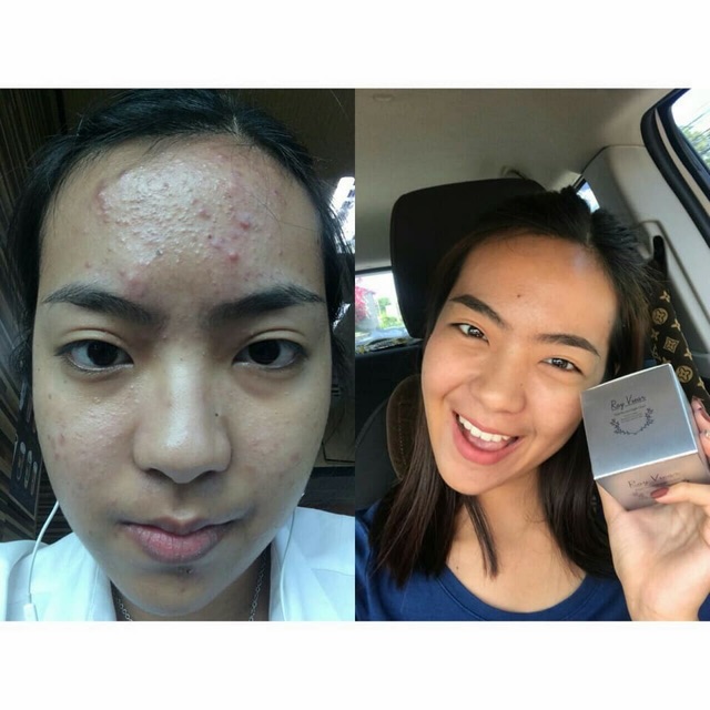 Ray Viear Plant Placenta Night Cream เรเวียร์ แพลนต์ พลาเซนต้า (ไนท์ ...