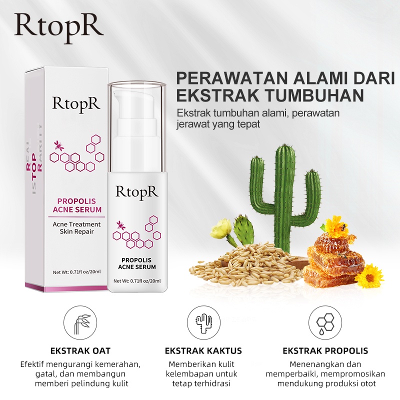 RtopR เซรั่มลดสิว เผยผิวกระจ่างใส บอกลาปัญหาสิว สูตรช่วยลดสิวและควบคุม ...