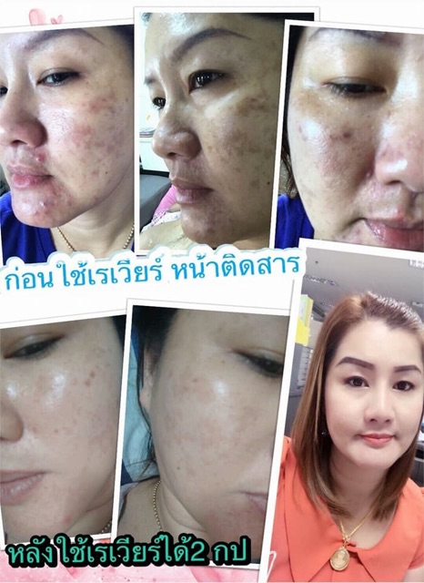 Ray Viear Plant Placenta Night Cream เรเวียร์ แพลนต์ พลาเซนต้า (ไนท์ ...