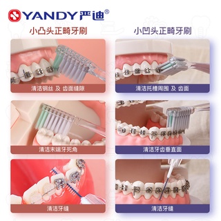 ♈Yan Di Orthodontic Toothbrush Concave and Convex Children Adult ...