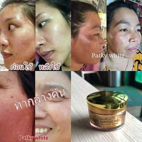 แพ็คกี้ไวท์ ชุดครีมแก้ฝ้าสบู่ (กลางวันกลางคืนกันแดดสบู่ทับทิมคอลลาเจน) Patky White ของแท้ 100 ...