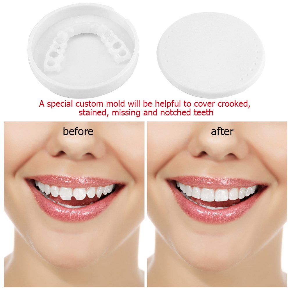 Teeth Cosmetic Whitening Denture Fake Tooth Cover and Storage Box ...
