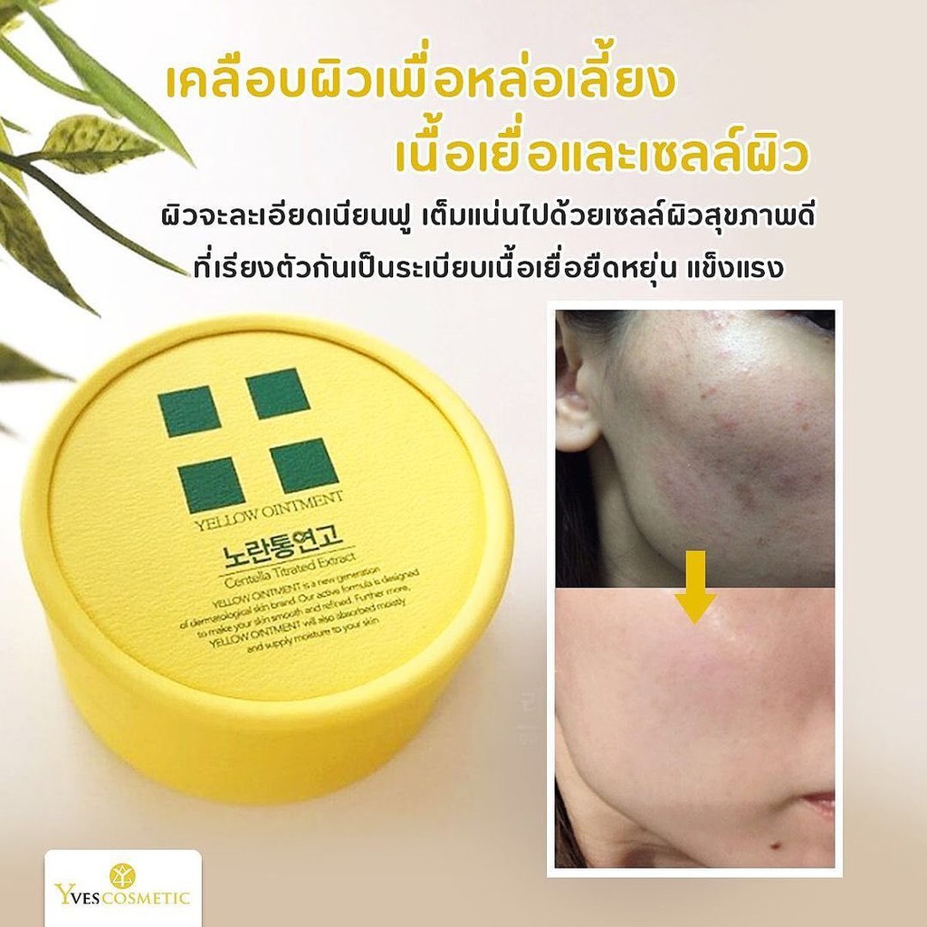 พร้อมส่งด่วน ส่งฟรี Yellow Ointment Centella treated Extract 18 g. ครีม ...