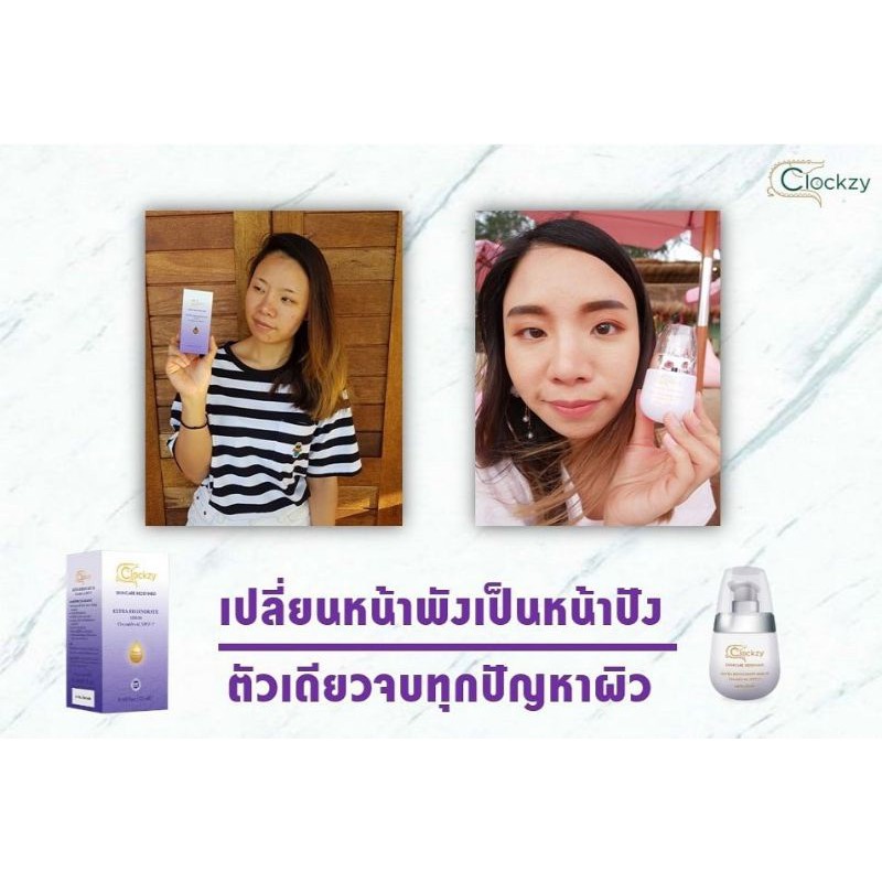 เซรั่ม ลดรอยสิว (1แถม1สุดคุ้ม) ลดริ้วรอย หน้าใส หน้าดูอ่อนวัย ลดริ้วรอย รอยแดง รอยตีนกา แท้ (By ...