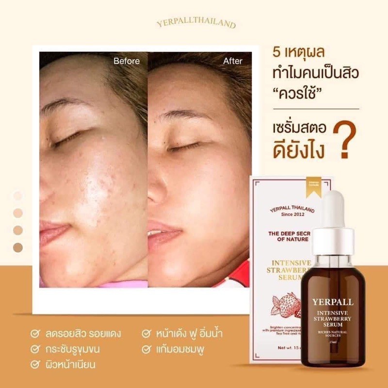 Yerpall Serumเซรั่มผัก เซรั่มสตอเบอรี่ ขนาด 15 ml. ของแท้ ...