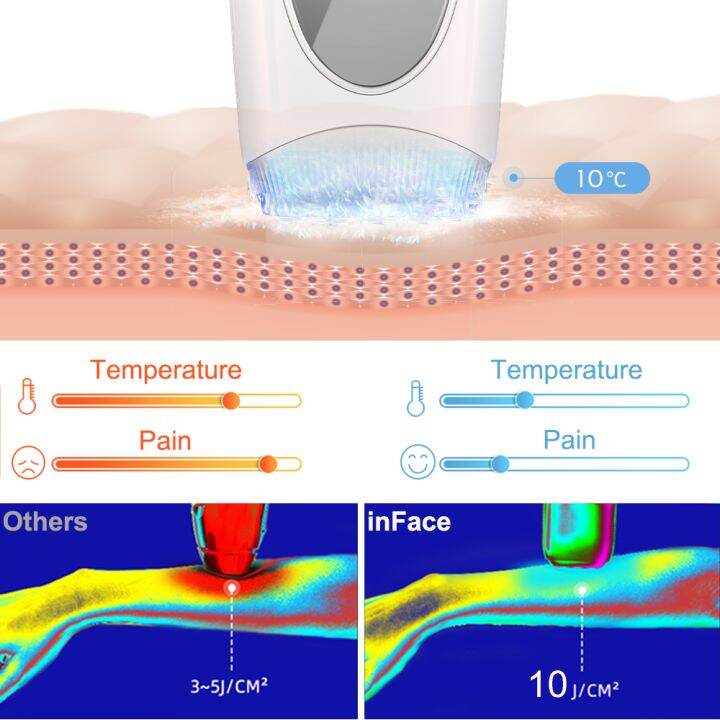 (ของแท้100พร้อมส่งจากรุงเทพ) Xiaomi inFace IPL Crystal Freezing Point ...