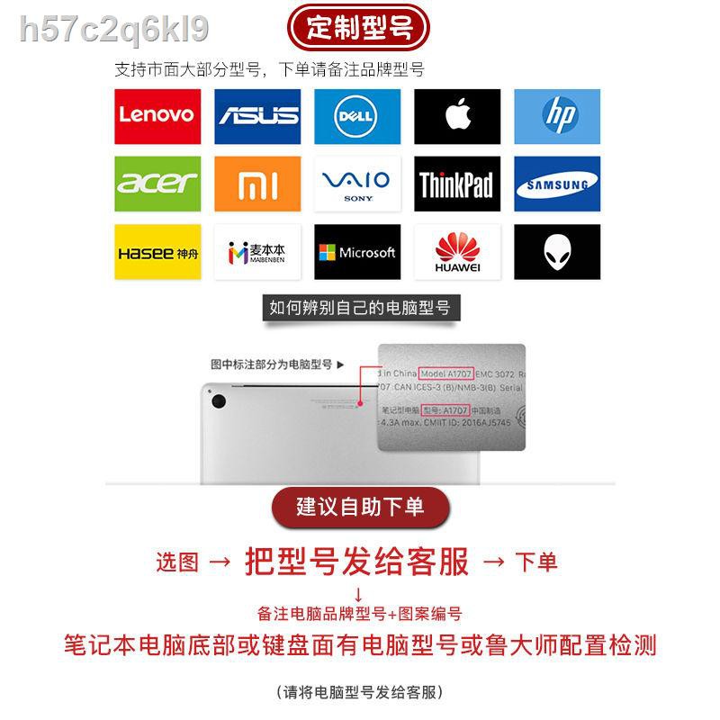 Shenzhou Ares Computer Sticker Z7M-KP5S Turion Notebook Film Fine Shield K580 Shell Protective ...