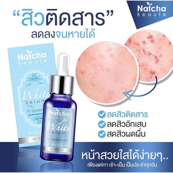 Natcha Beaute White Serum ณัชชา บิวตี้ ไวท์ เซรั่ม [30 ml./ขวด] [2 ขวด] เซรั่มณัชชา ลดสิวและจุด ...