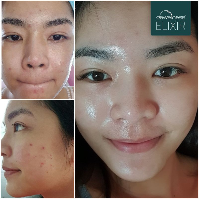 พร้อมส่ง‼️???? Beauty Water น้ำค้างเช็ดผิวพร้อมบำรุง 6 in 1 DEWellness Elixir - i2swlsq_ir ...