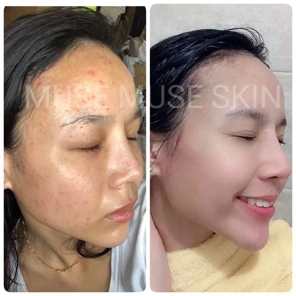 พอกกู๊ดโสม ขัด ????สครับมะขามนมผึ้ง Muse muse skin มาส์ก+ครับ2in1 ลดสิว ...