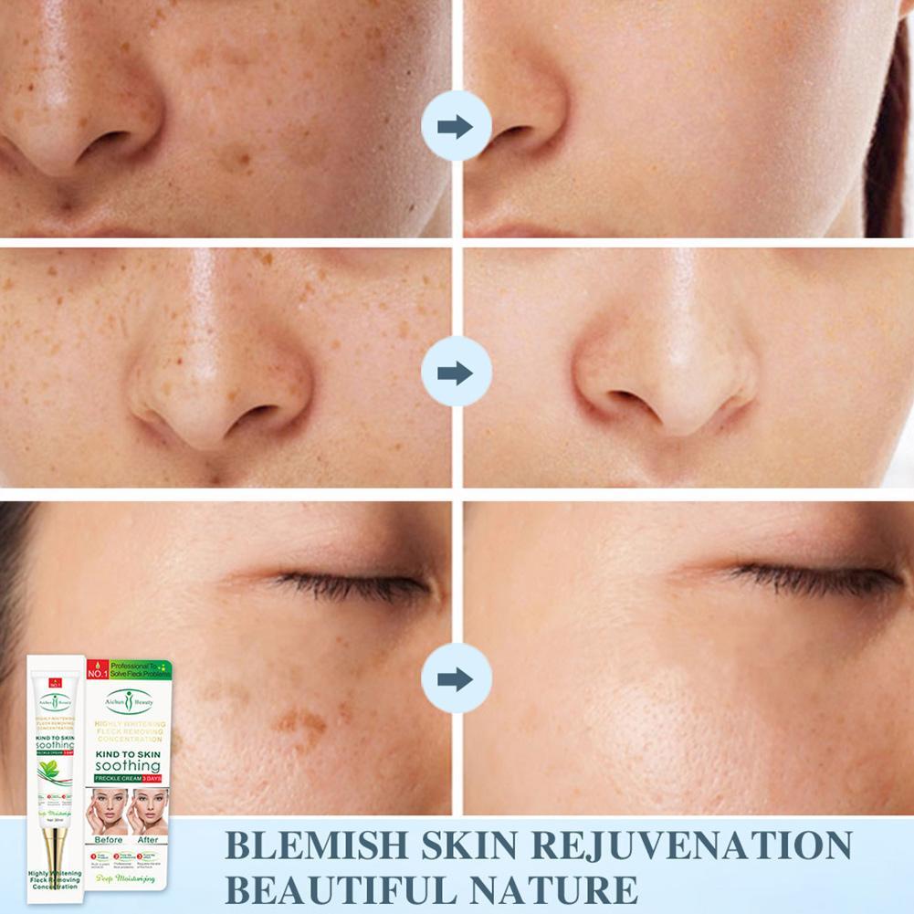 Ai Chun Aichun ครีมบํารุงผิวหน้าต่อต้านริ้วรอยสําหรับผู้ชายและผู้หญิง ...