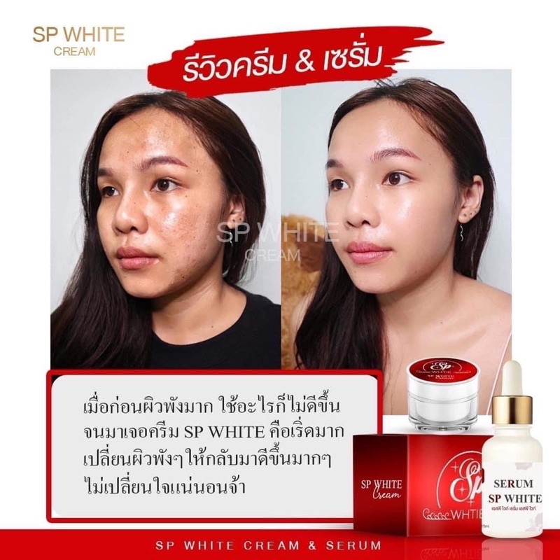 ของแท้ ครีมSp White เซรั่มSP WHITE ลดฝ้า กระ จุดด่างดำ ฟื้นฟูผิวขาว ...