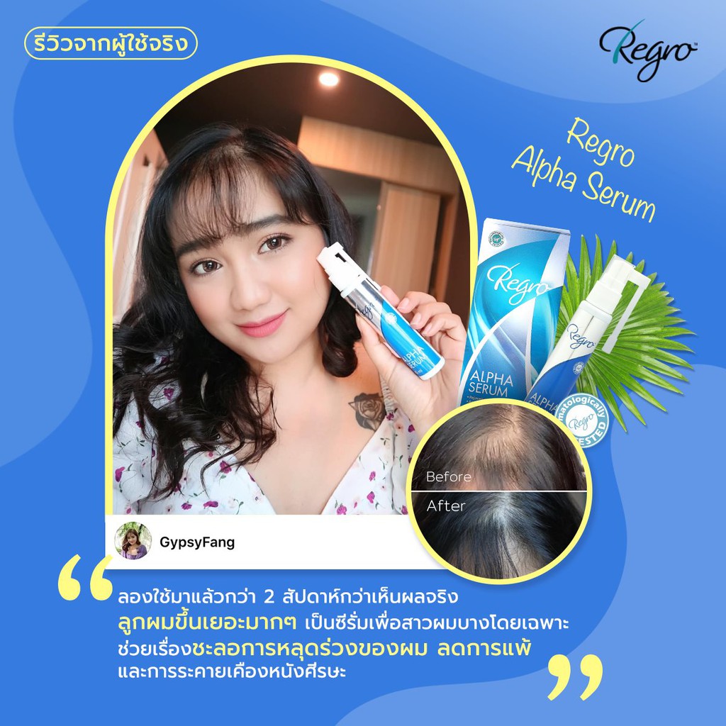 Regro Alpha Serum free Regro Color Shine Shampoo 100ml.ซีรั่มกระตุ้นการสร้างผมใหม่แถมแชมพูลดผม ...
